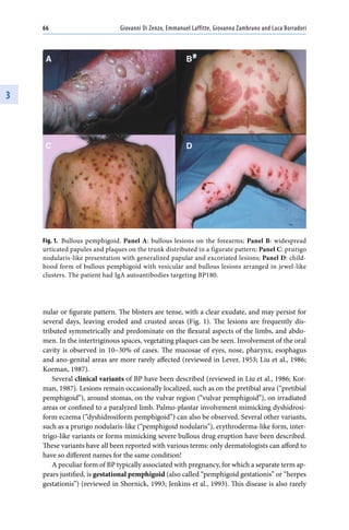 Autoimmune Diseases of the Skin_ Pathogenesis, Diagnosis, Management ...