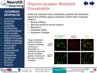 Autoimmune encephalitis | PPT