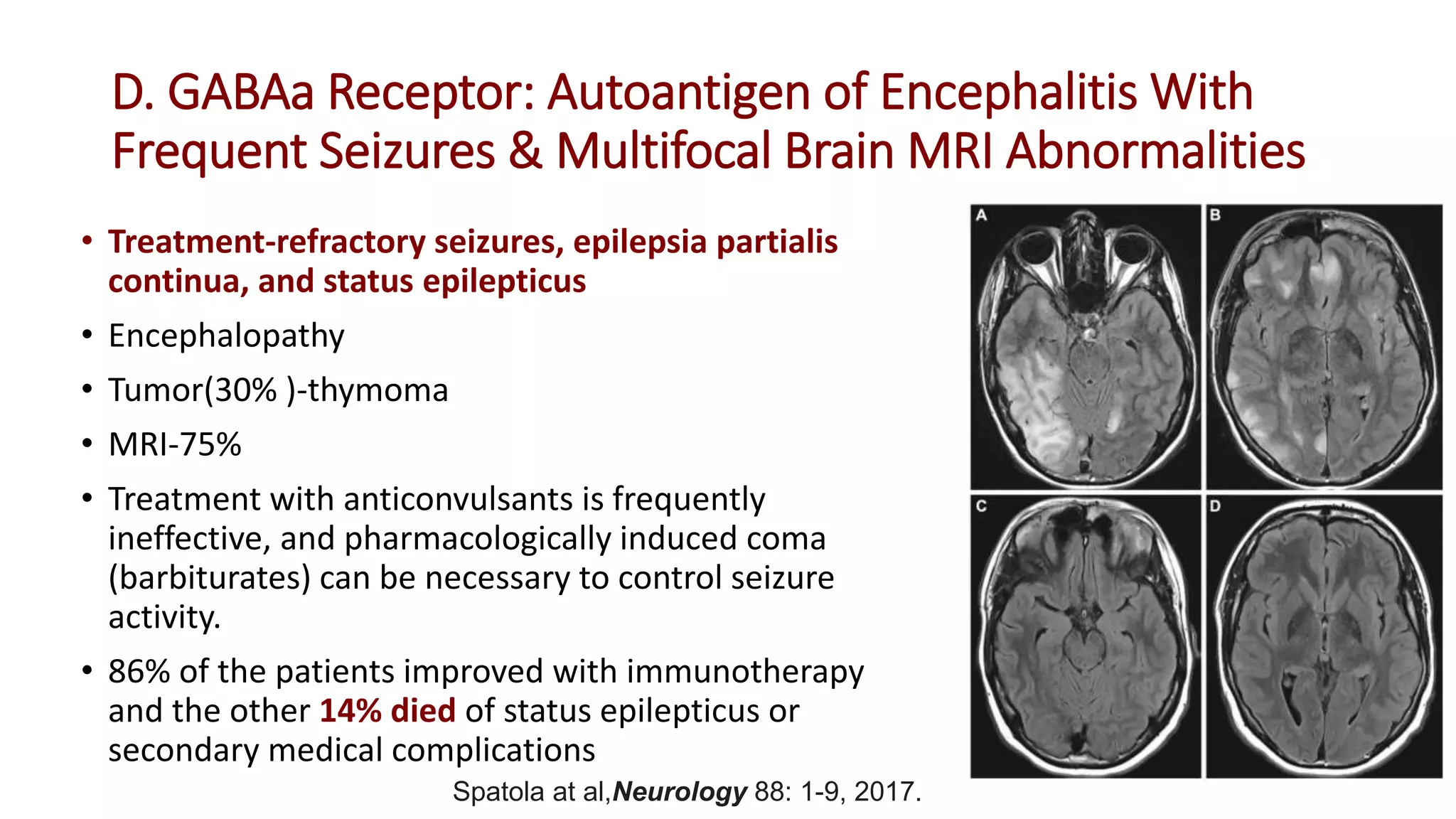 Autoimmune Encephalitis | PPTX