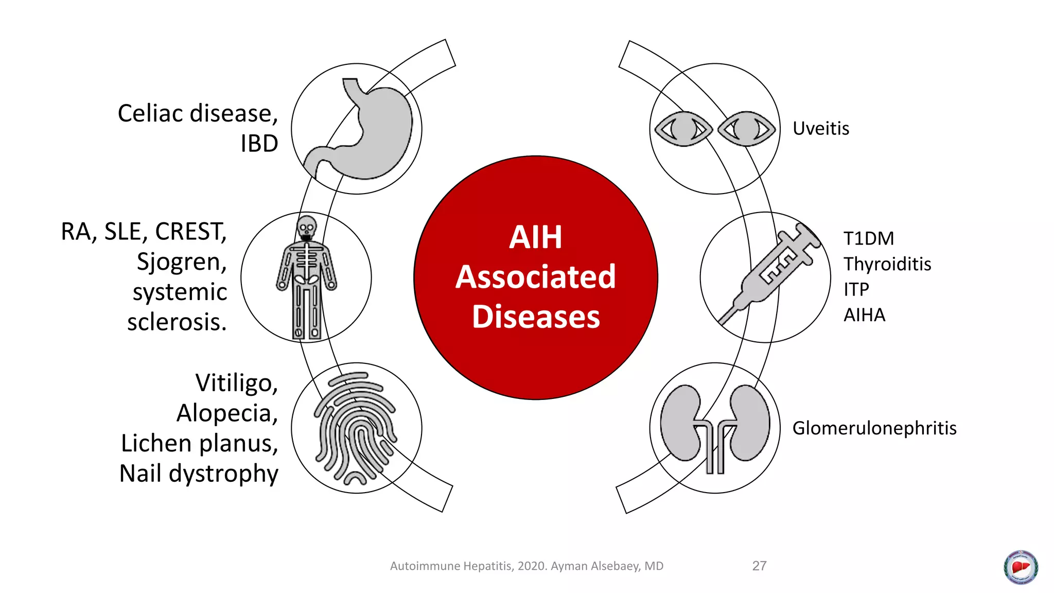 Autoimmune Hepatitis Part I | PPTX