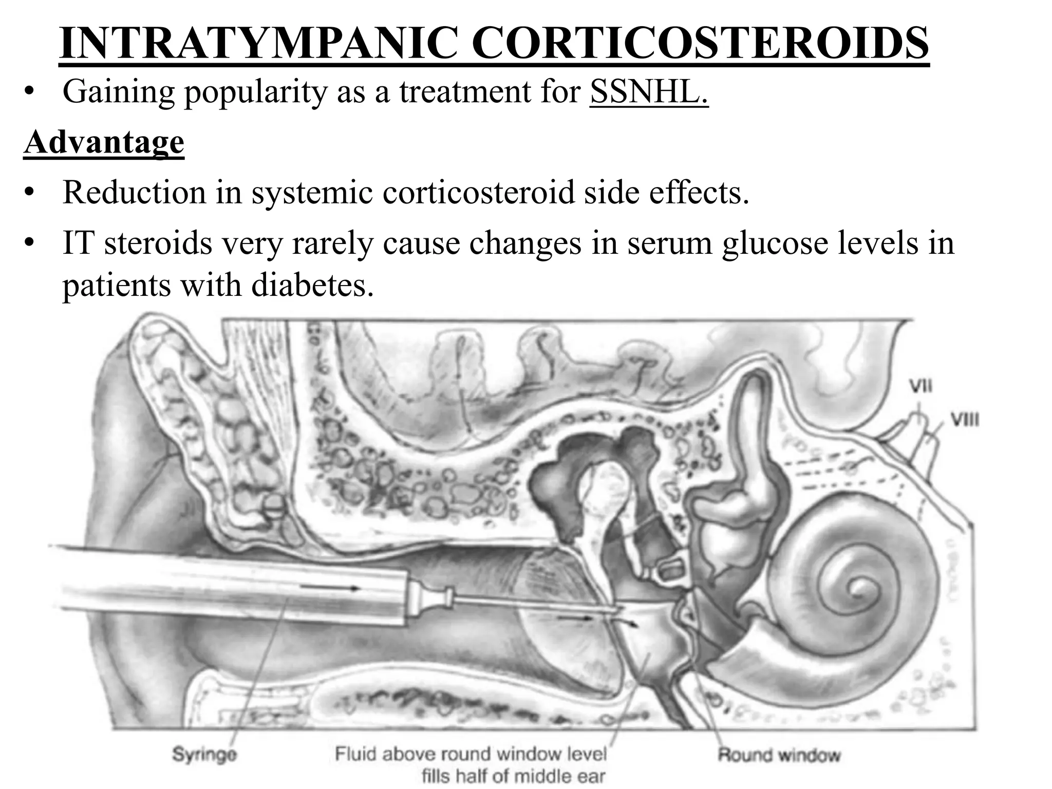 Autoimmune inner ear disease(AIED) | PPTX