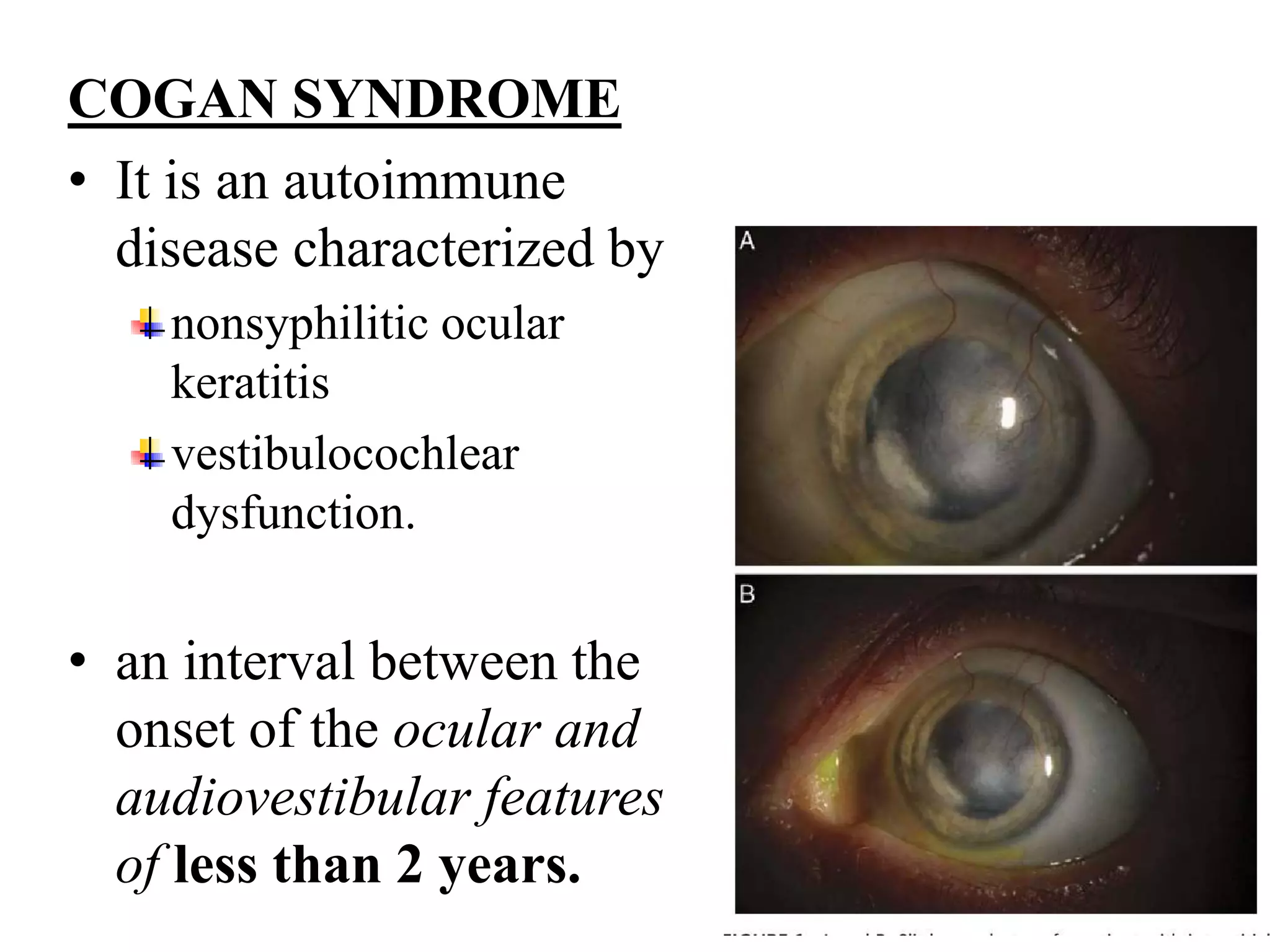 Autoimmune inner ear disease(AIED) | PPTX
