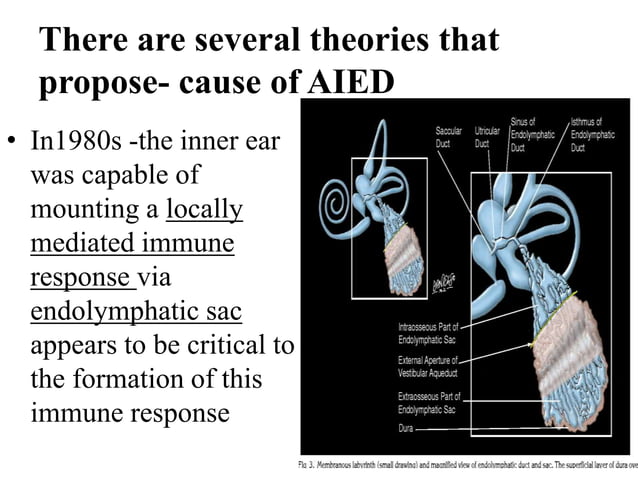 Autoimmune inner ear disease(AIED) | PPTX | Ear, Nose and Throat ...