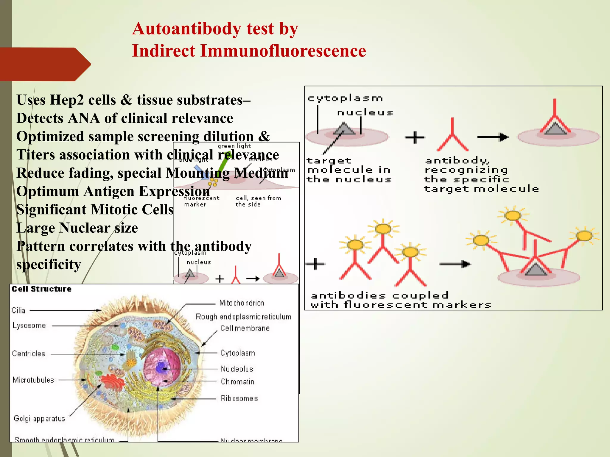 Autoimmune liver disease laboratory diagnosis | PPT