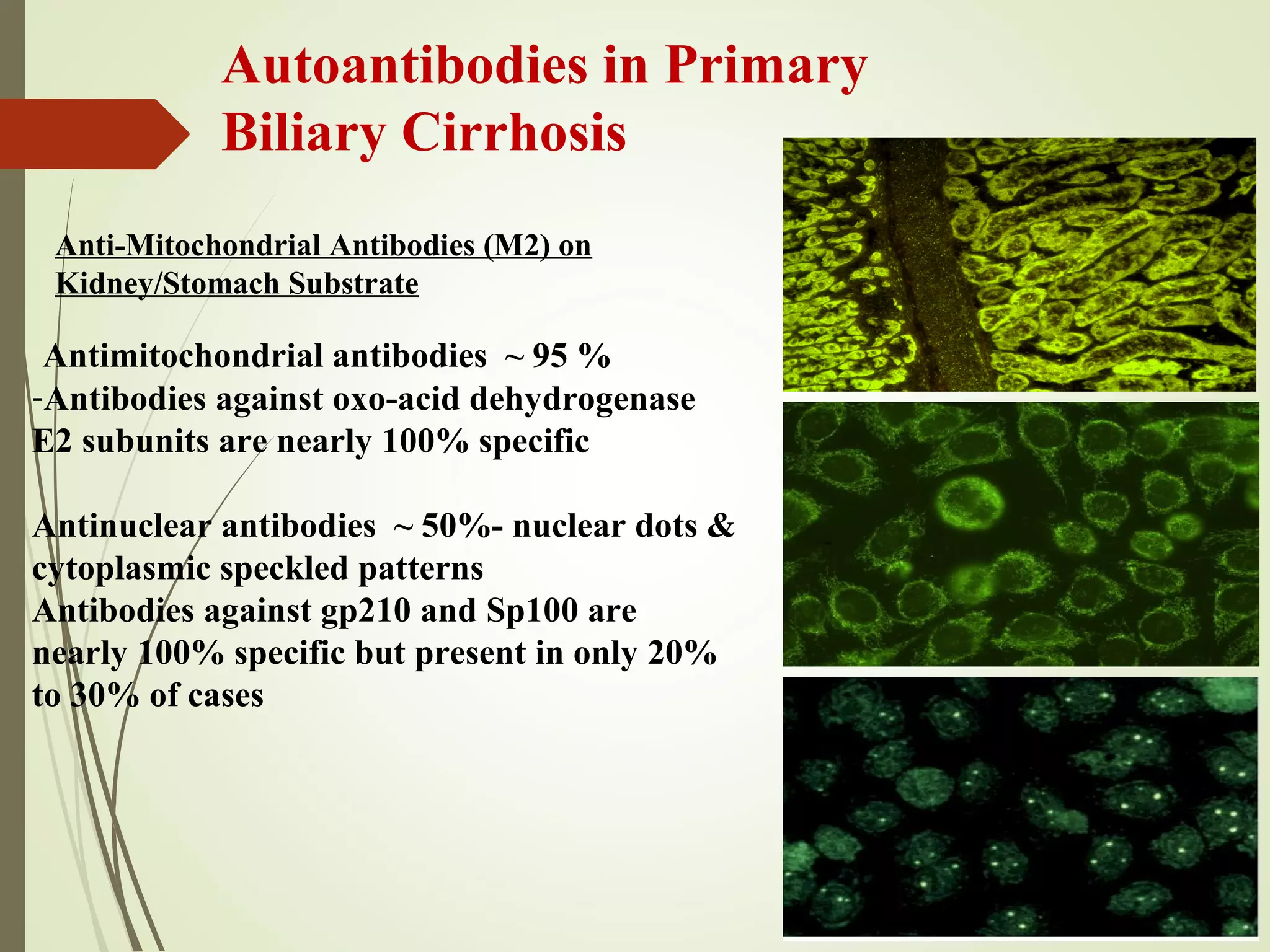 Autoimmune liver disease laboratory diagnosis | PPT