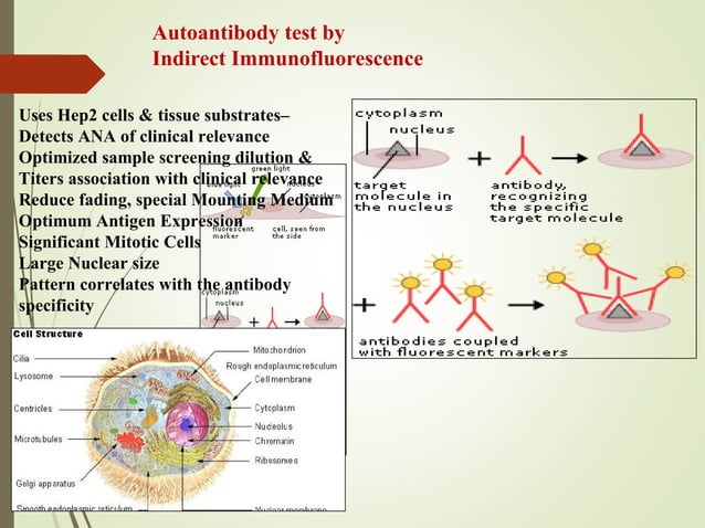 Autoimmune liver disease laboratory diagnosis | PPT