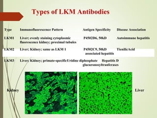 Autoimmune liver disease laboratory diagnosis | PPT