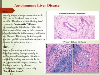 Autoimmune liver disease laboratory diagnosis | PPT