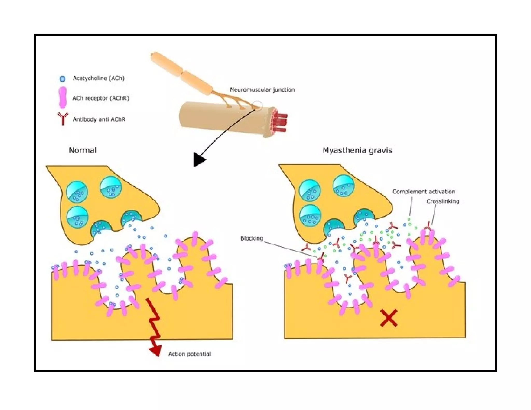 Autoimmune nervous system disorders | PDF