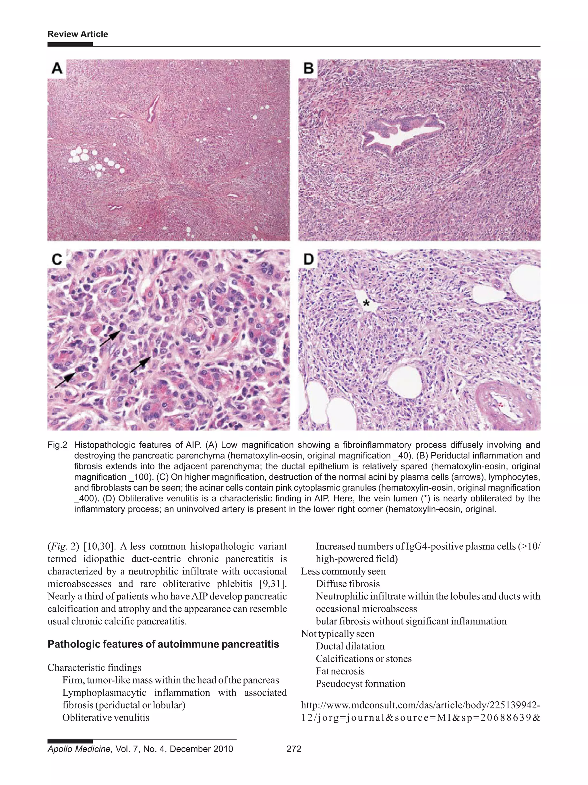 Autoimmune Pancreatitis | PDF