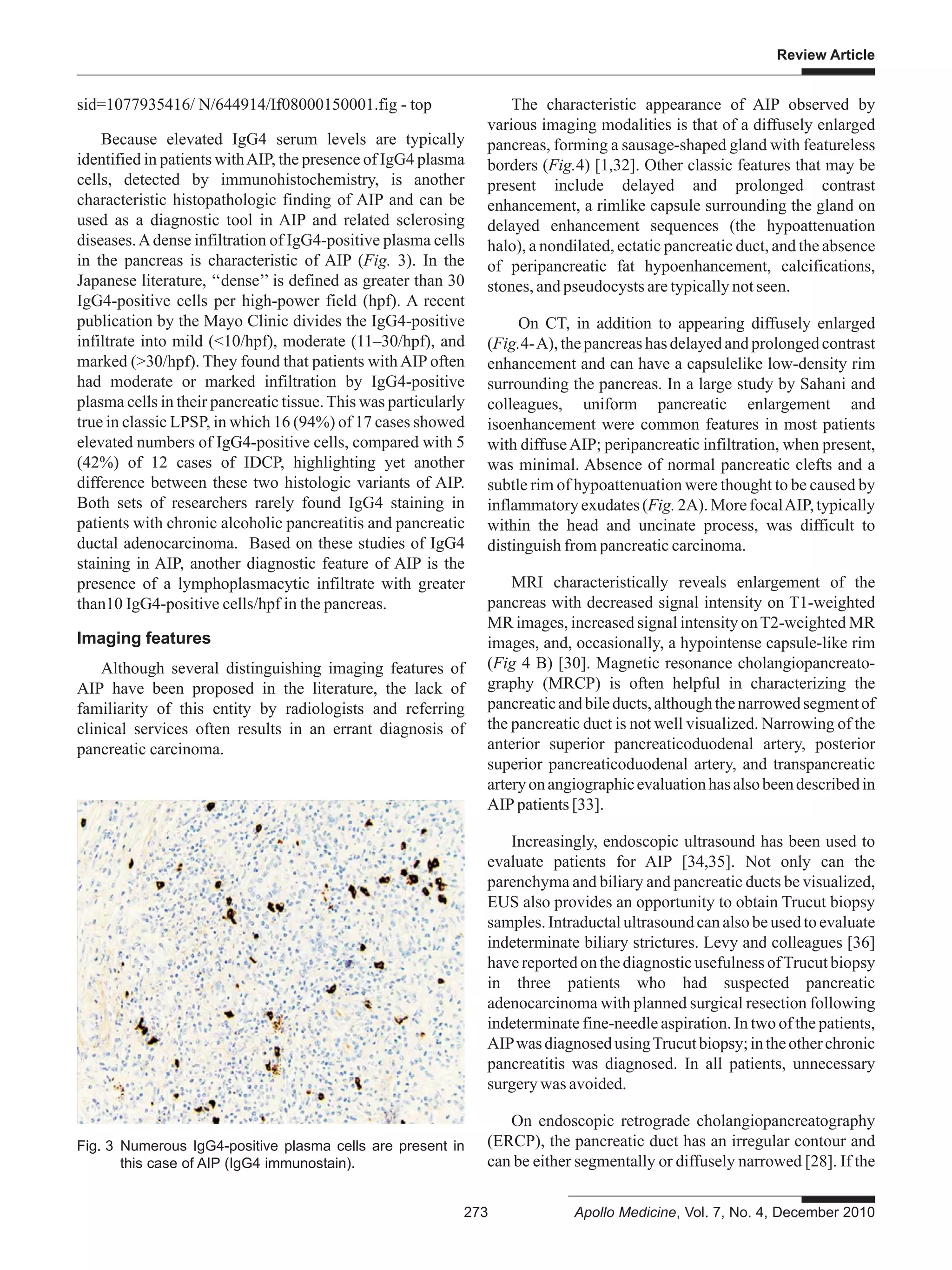 Autoimmune Pancreatitis | PDF