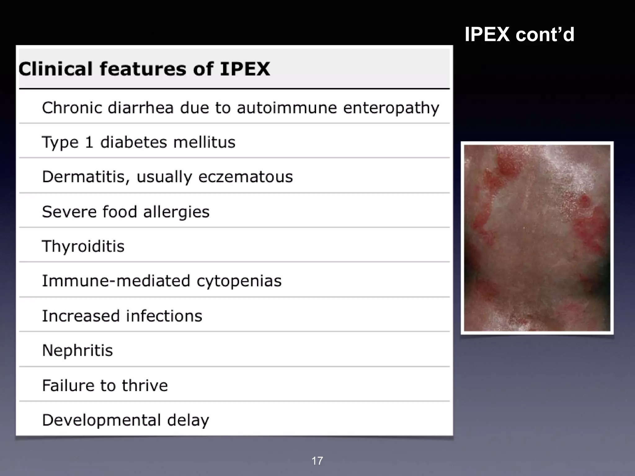 Autoimmune polyendocrine syndromes | PPTX