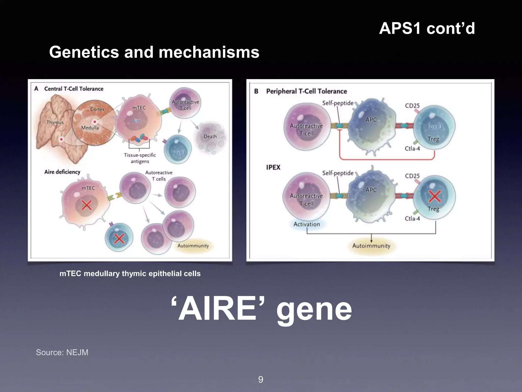Autoimmune polyendocrine syndromes | PPTX