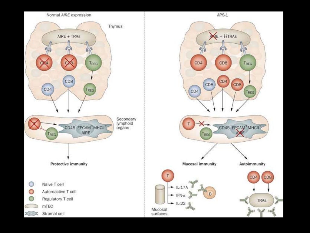 Autoimmune polyglandular syndromes