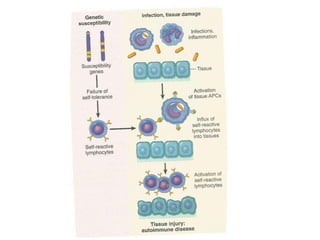 Autoimmunity | PPTX