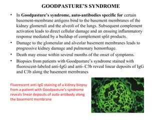 Autoimmunity | PPT