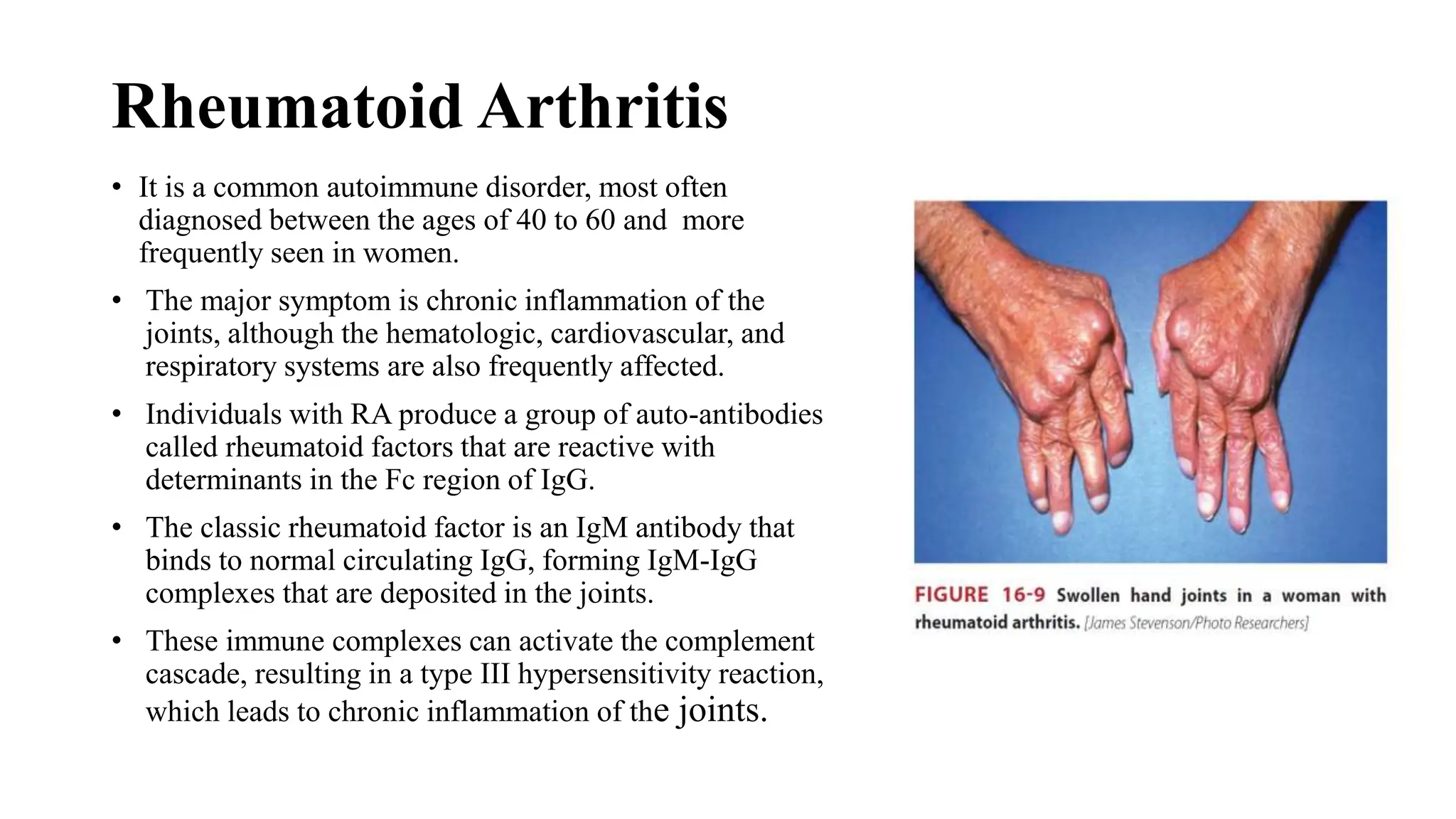 Autoimmunity and Autoimmune diseases.pptx