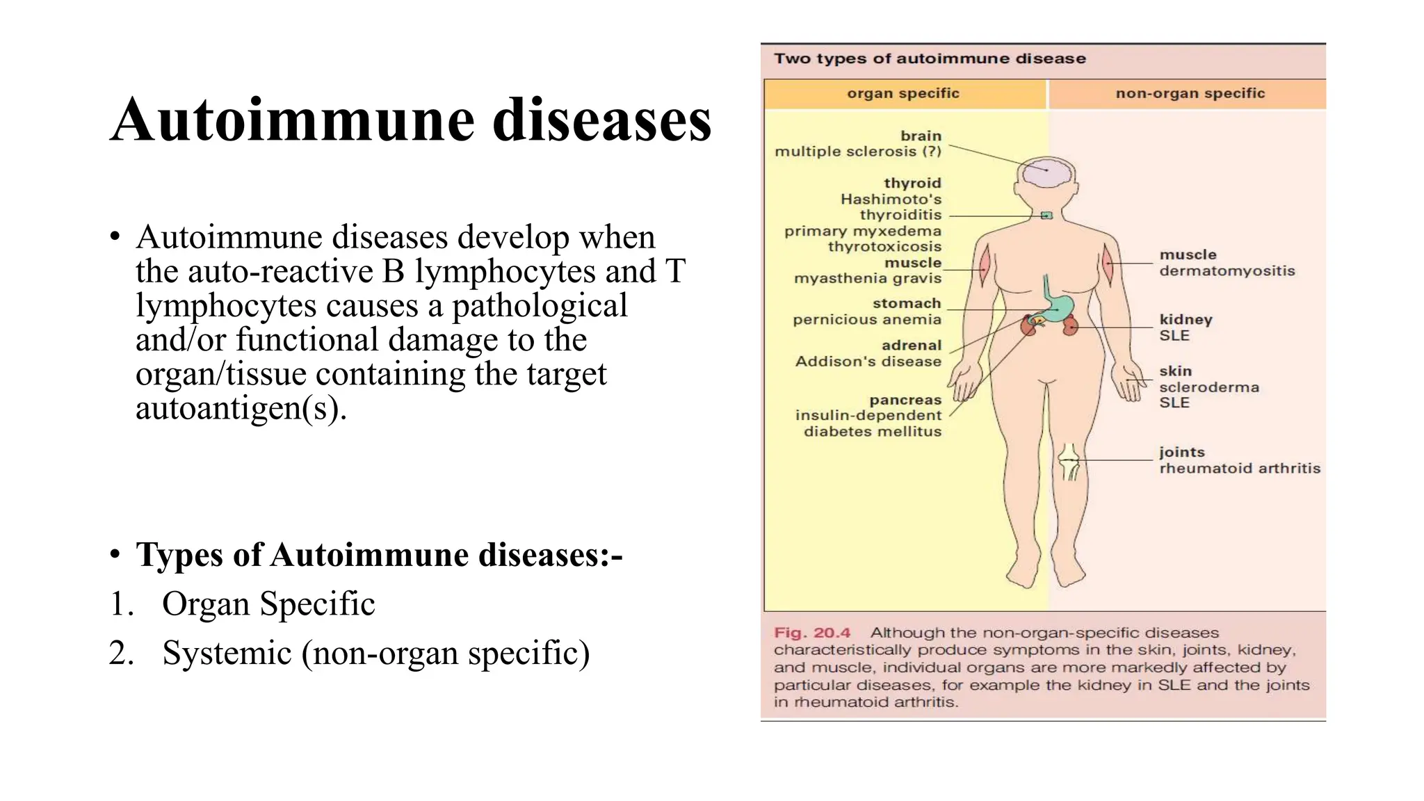 Autoimmunity and Autoimmune diseases.pptx