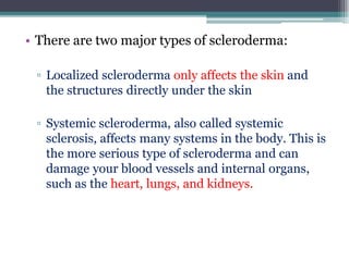 AUTOIMMUNITY AND AUTO IMMUNE DISEASES.pdf