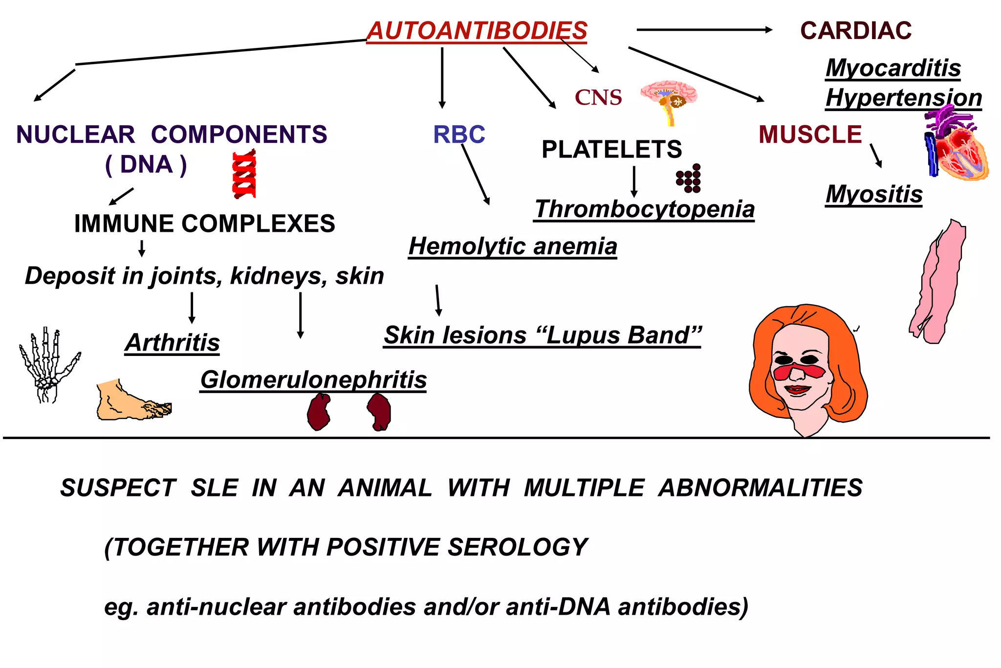 Autoimmunity-and-Autoimmune-disorders.pdf