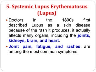 Autoimmunity and Autoimmune Diseases | PPT