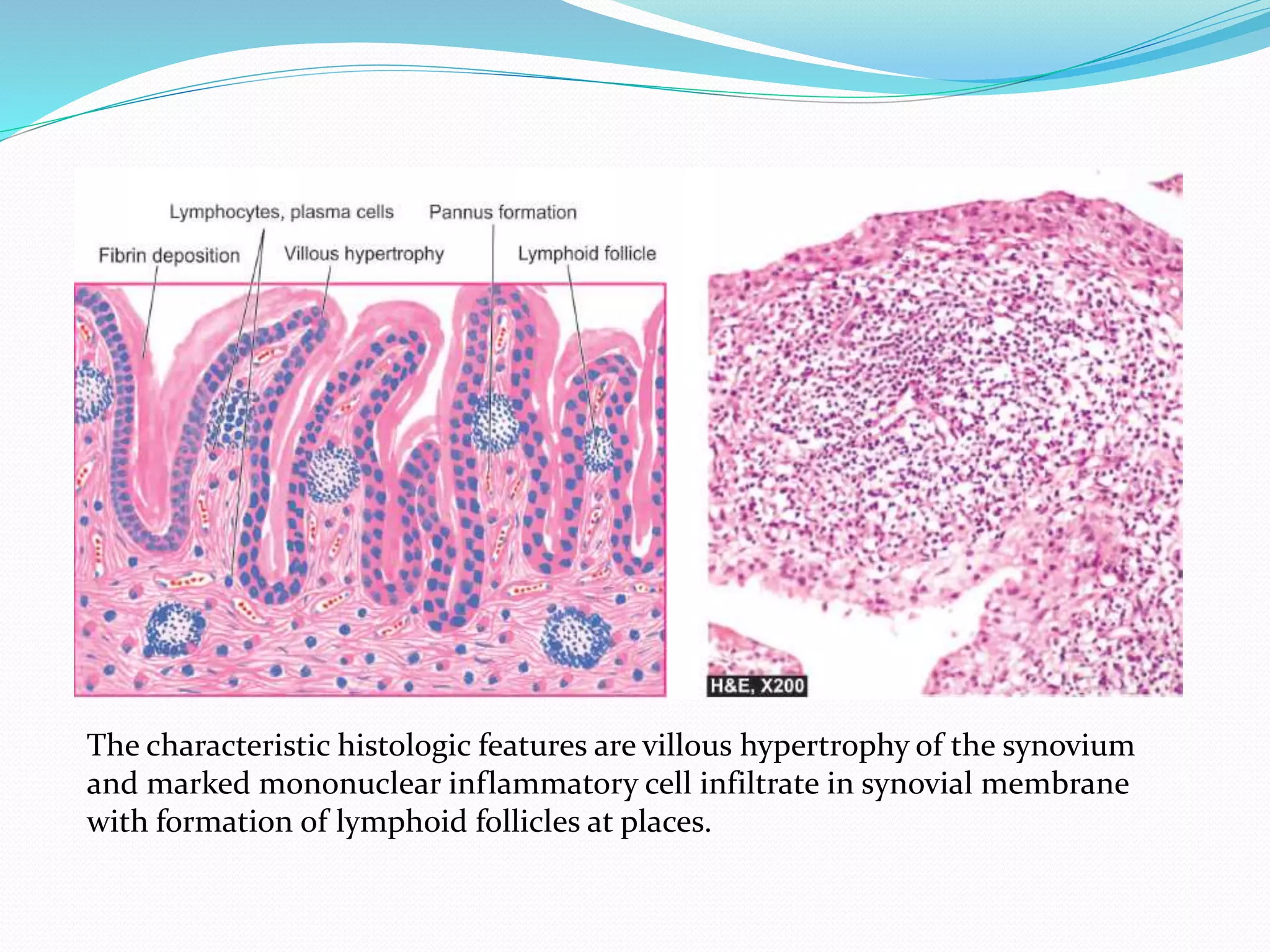 Autoimmunity | PPTX