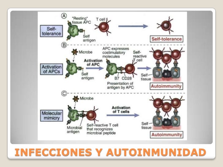 Autoinmunidad
