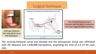 Journal Club on Autologous blood injection for the treatment of ...