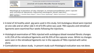 Journal Club on Autologous blood injection for the treatment of ...