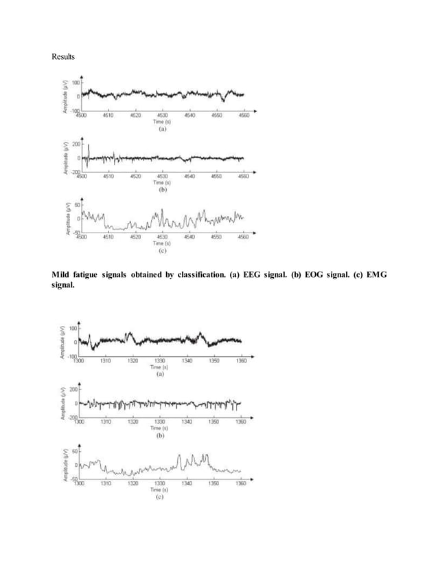 Ieee 2014 Matlab Image Processing Projects Automated Detection Of Driver Fatigue Based On