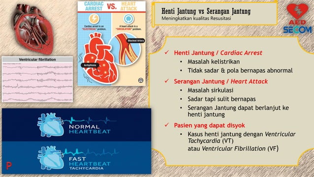 Automated External Defibrillator alat pacu jantung (AED)F | PPT