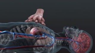 Automated External Defibrillator alat pacu jantung (AED)F | PDF