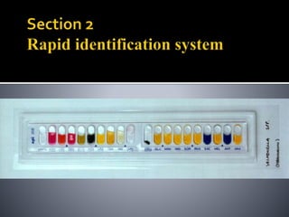 Automated methods in the microbiology lab | PPTX