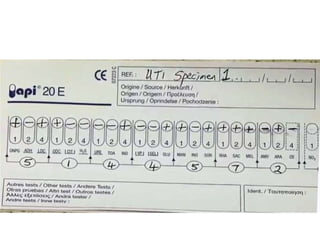Automated methods in the microbiology lab | PPTX