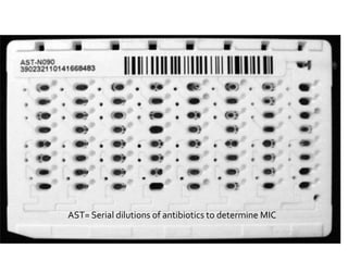 Automated methods in the microbiology lab | PPTX