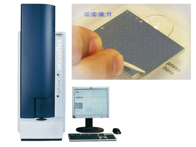 Automated methods in the microbiology lab | PPTX