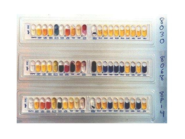 Automated methods in the microbiology lab