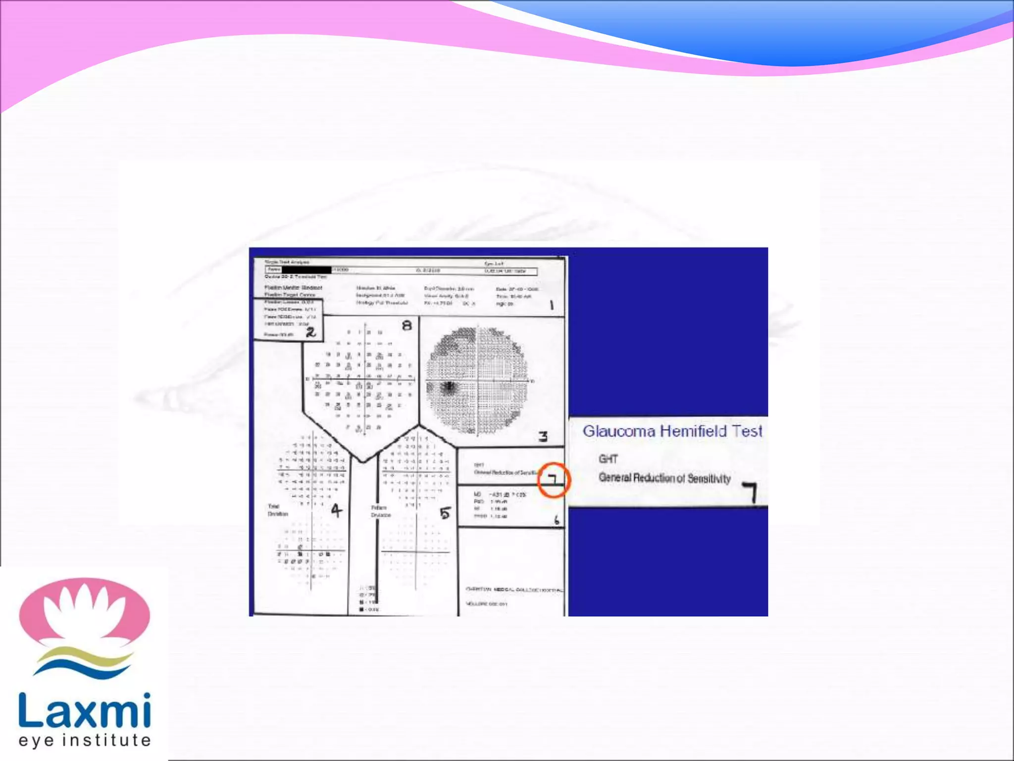 Automated perimetry | PPTX