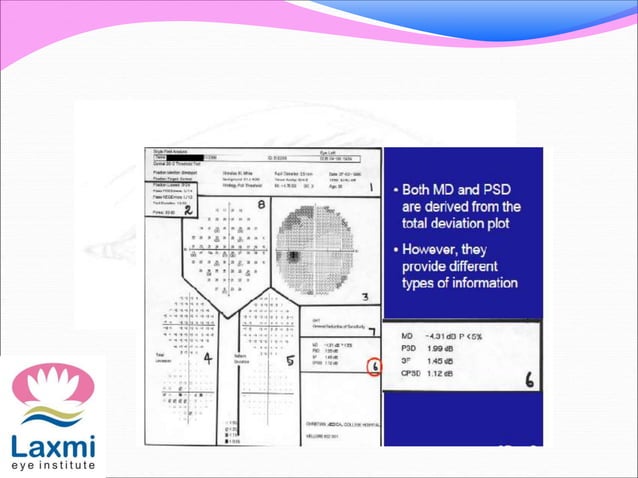 Automated perimetry | PPTX | Eye and Vision Conditions | Diseases and ...
