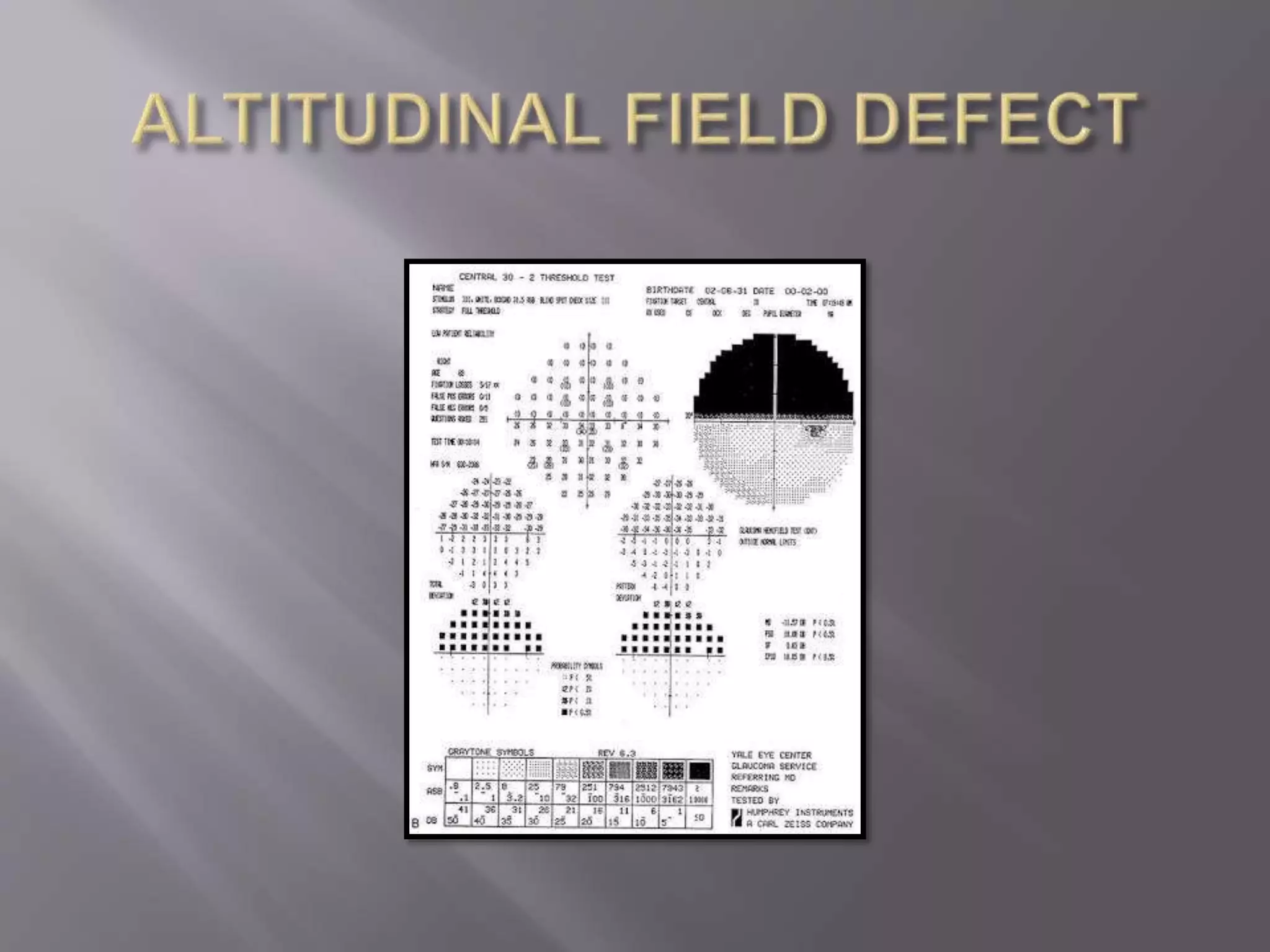 Automated perimetry | PPTX