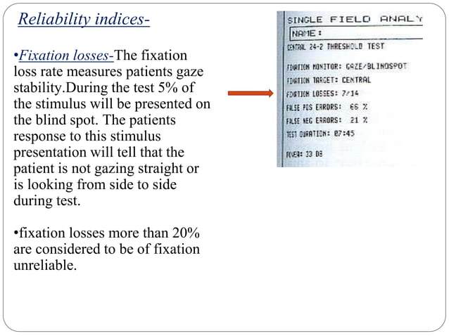 Automated perimetry | PPT