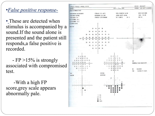 Automated perimetry | PPT