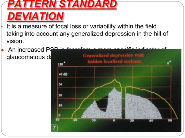 Automated perimetry | PPT