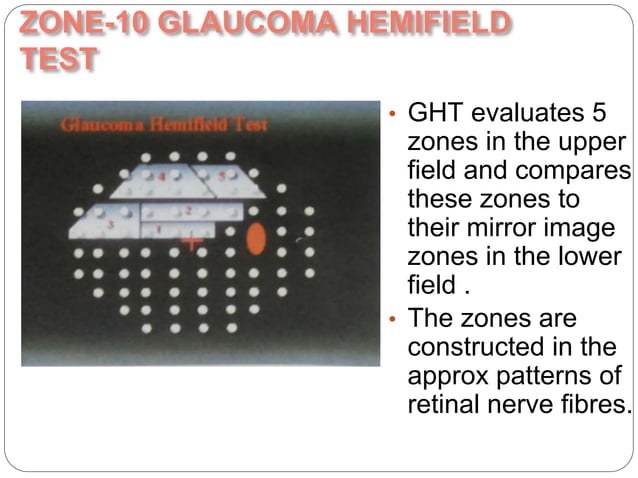 Automated perimetry | PPT