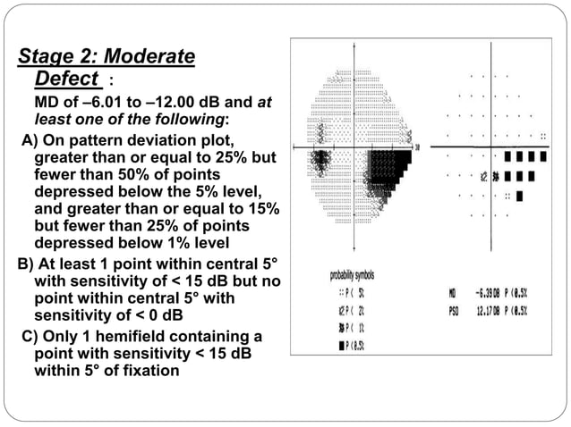 Automated perimetry | PPT