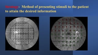 Automated Perimetry | PPTX