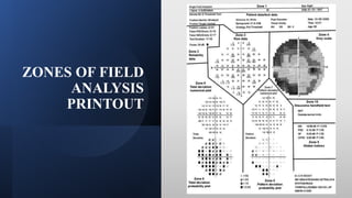 Automated Perimetry | PPTX