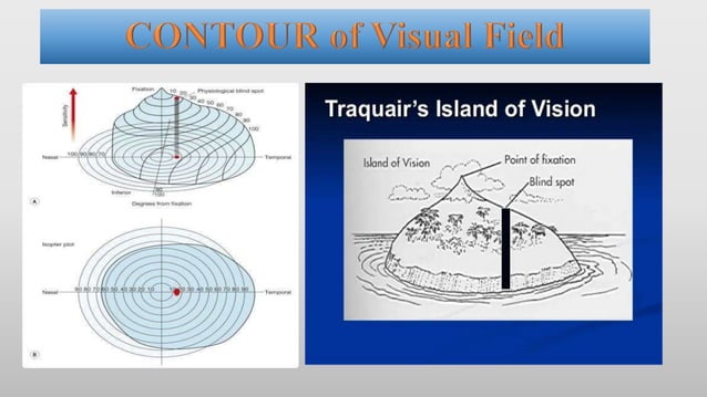 Automated Perimetry | PPT
