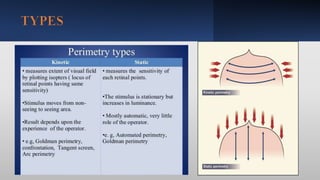 Automated Perimetry | PPTX