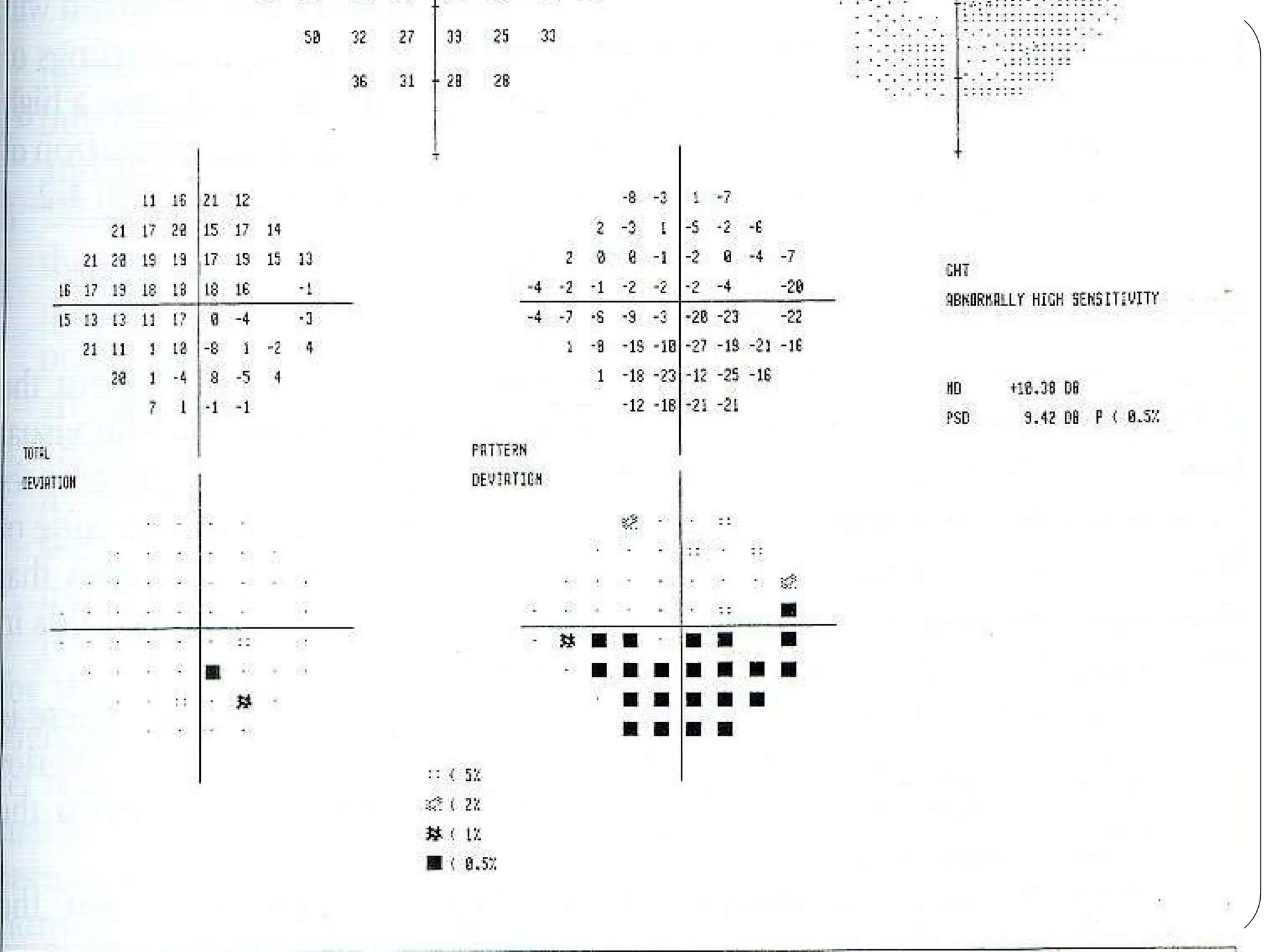 automated perimetry/ Humphrey's visual field.pptx